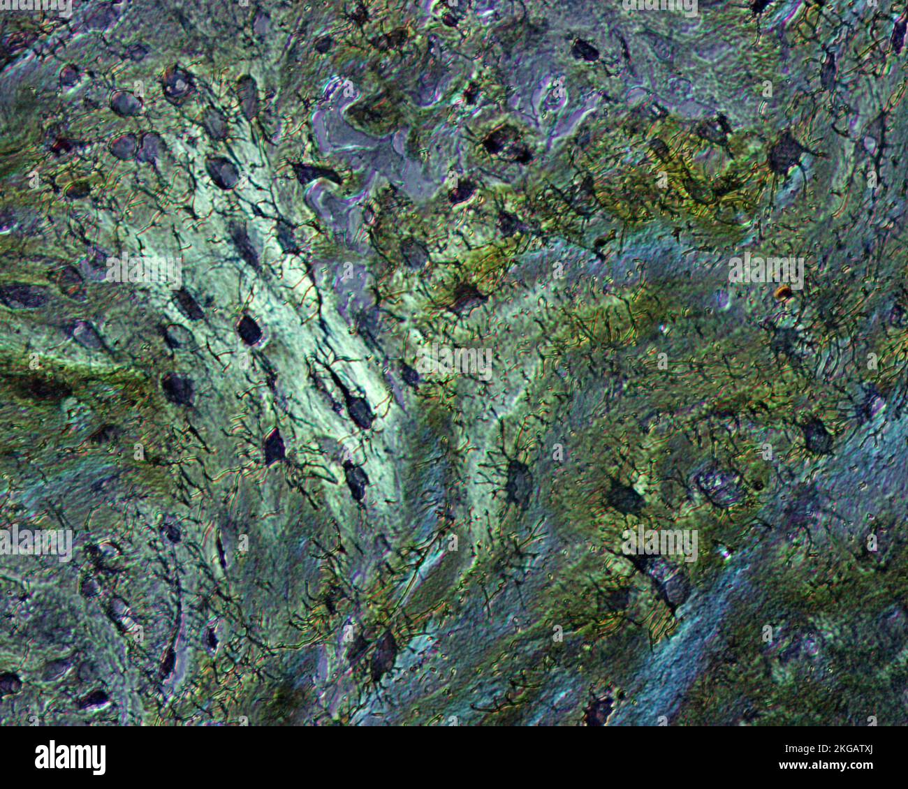 Compact bone, light micrograph. Bone is a dense matrix of calcium ...