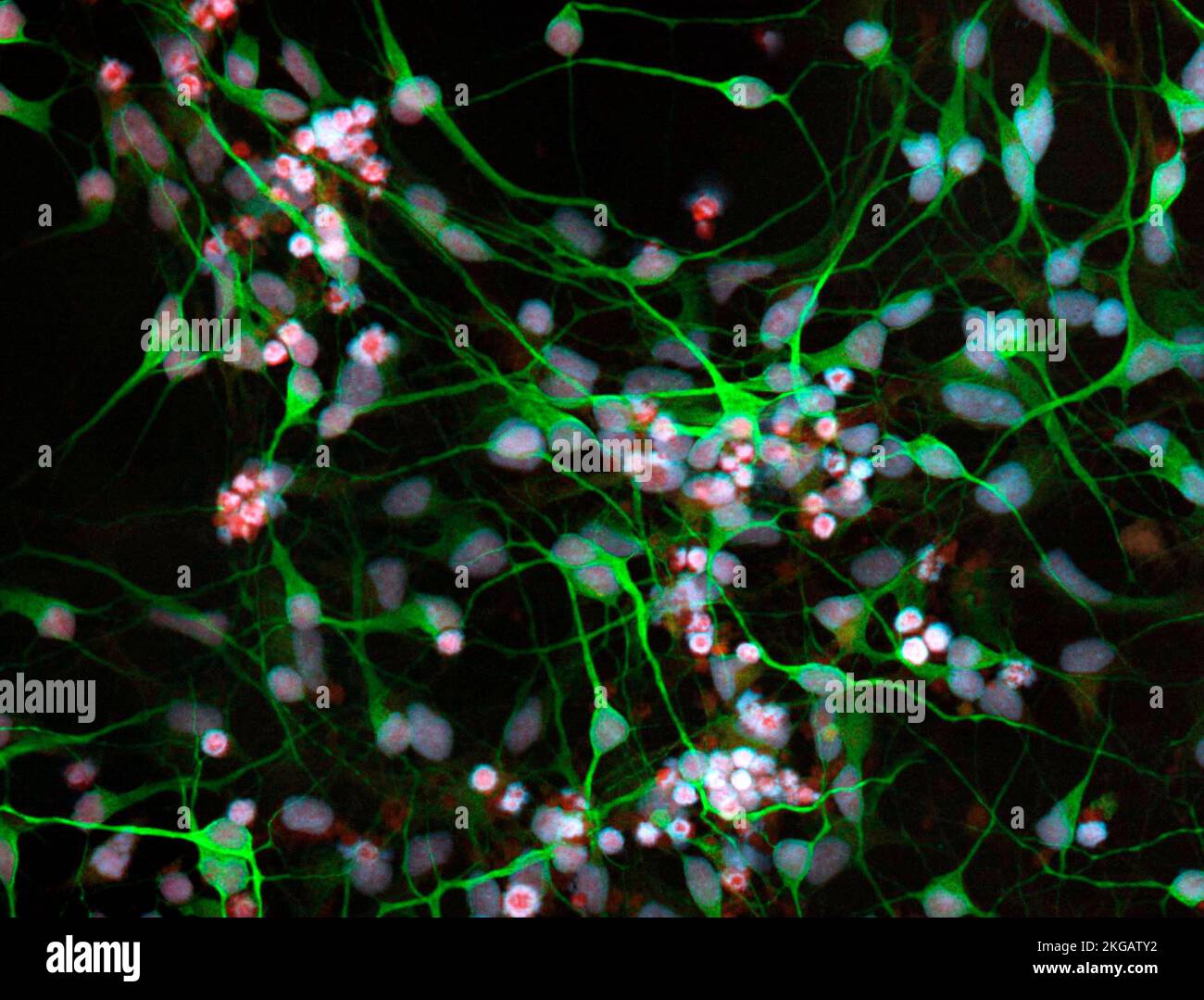 Fluorescence light micrograph of nerve cells (neurons) that have been ...