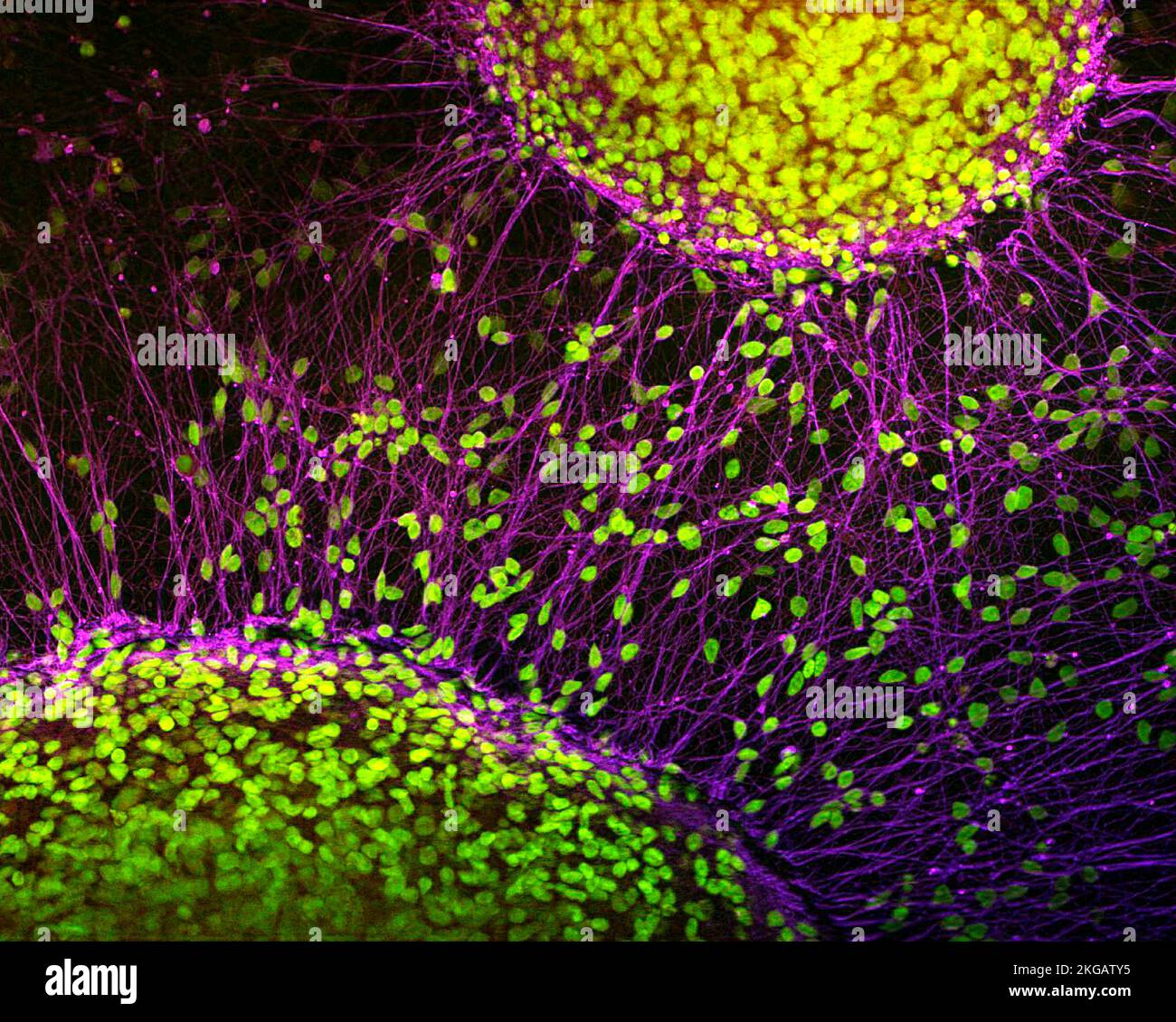 Fluorescence light micrograph of nerve cells (neurons) that have been ...