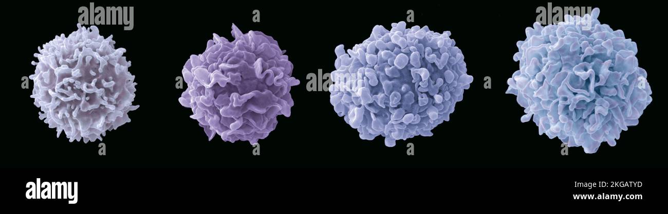 Lymphocyte white blood cells, coloured scanning electron micrograph ...
