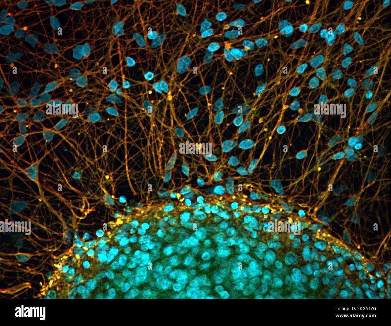 Fluorescence light micrograph of nerve cells (neurons) that have been ...