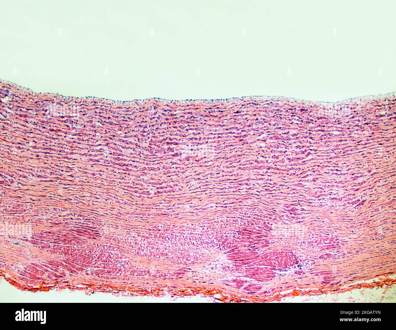 Light micrograph of a section through part of the wall of a normal ...