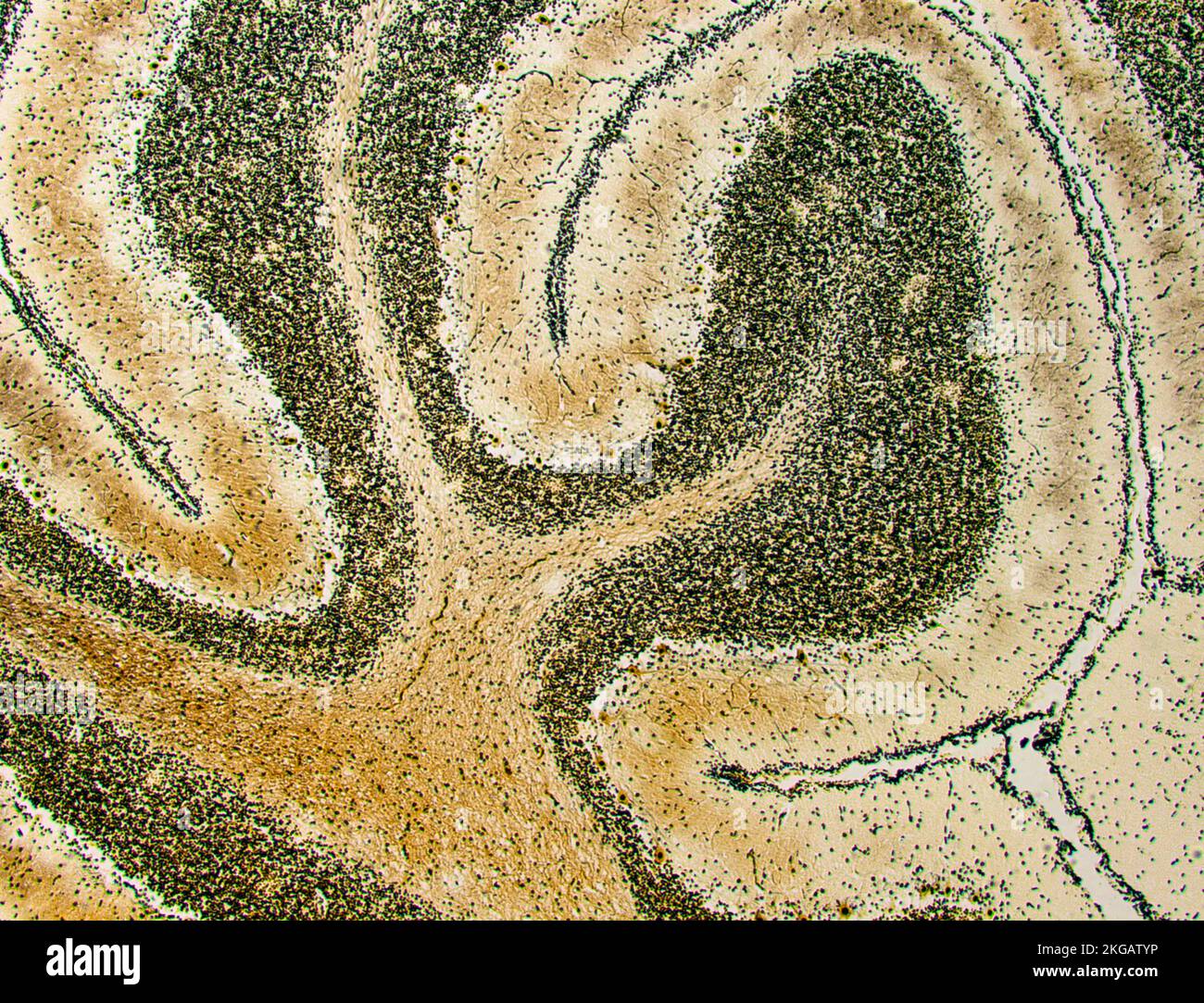 Light micrograph of a section through part of the cerebrum of the brain ...