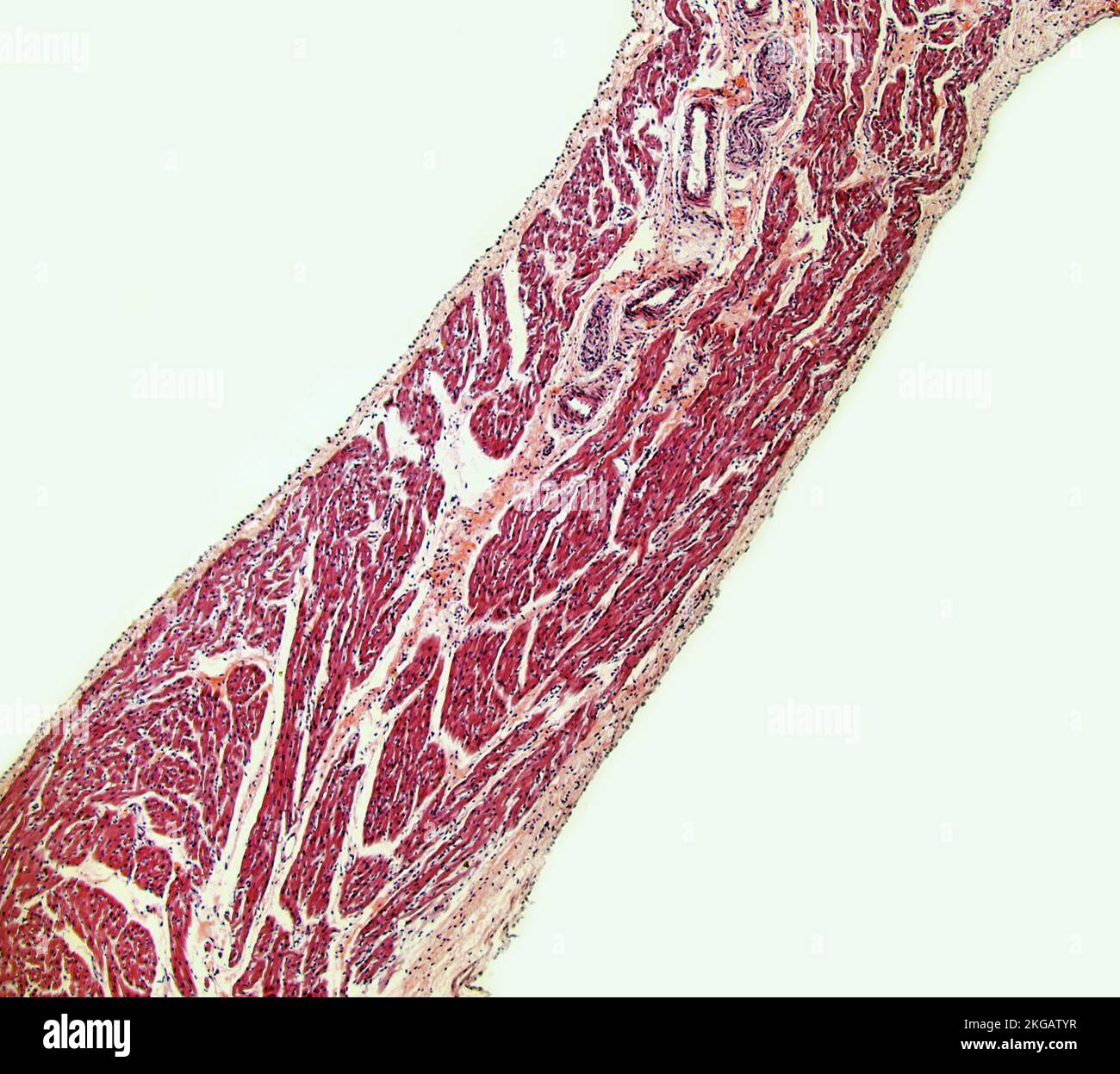 Light micrograph of a section through the muscular wall of the heart ...