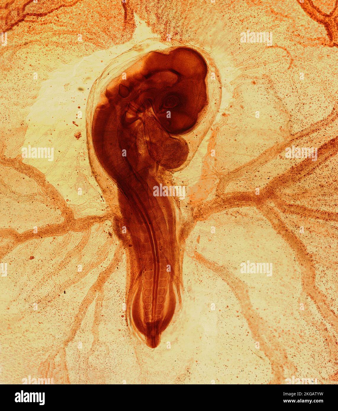 Chicken embryo, light micrograph Stock Photo - Alamy