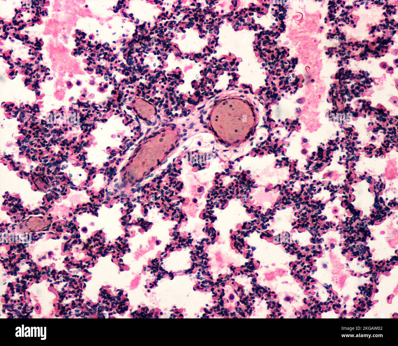 Light micrograph of a section through a mammalioan lung showing blood ...