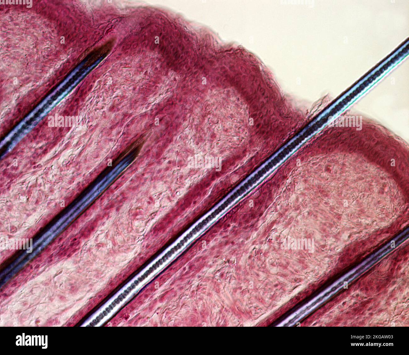Light micrograph of a section through skin showing four hairs (black ...