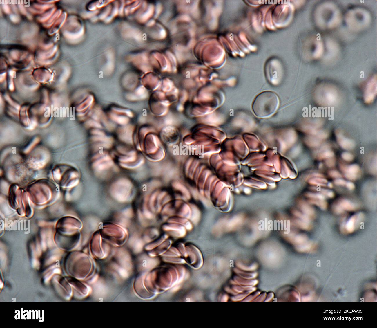 Light micrograph of human red blood cells (erythrocytes). Red blood ...