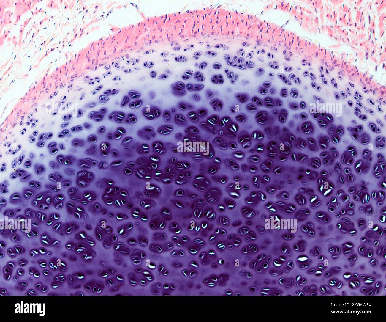 Light micrograph of cartilage showing chondrocytes (black) surrounded ...