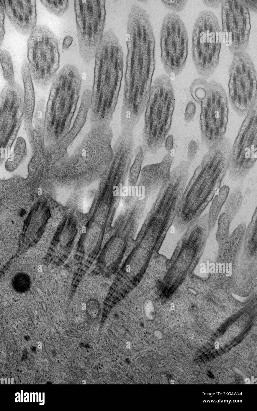 Transmission electron micrograph (TEM) of a section through respiratory epithelium. In the upper ...