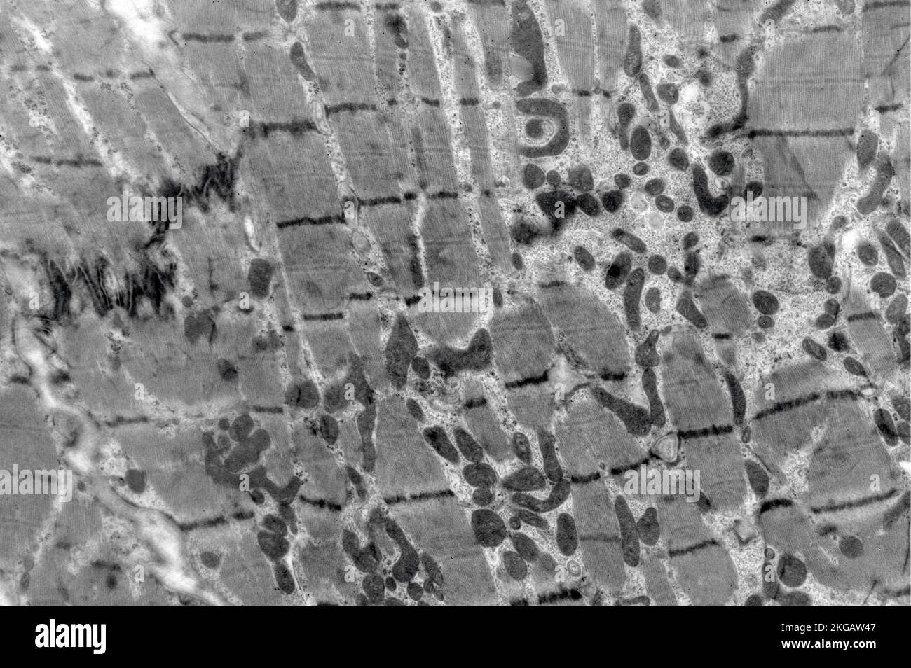 Transmission electron micrograph (TEM) of a section through a heart ...