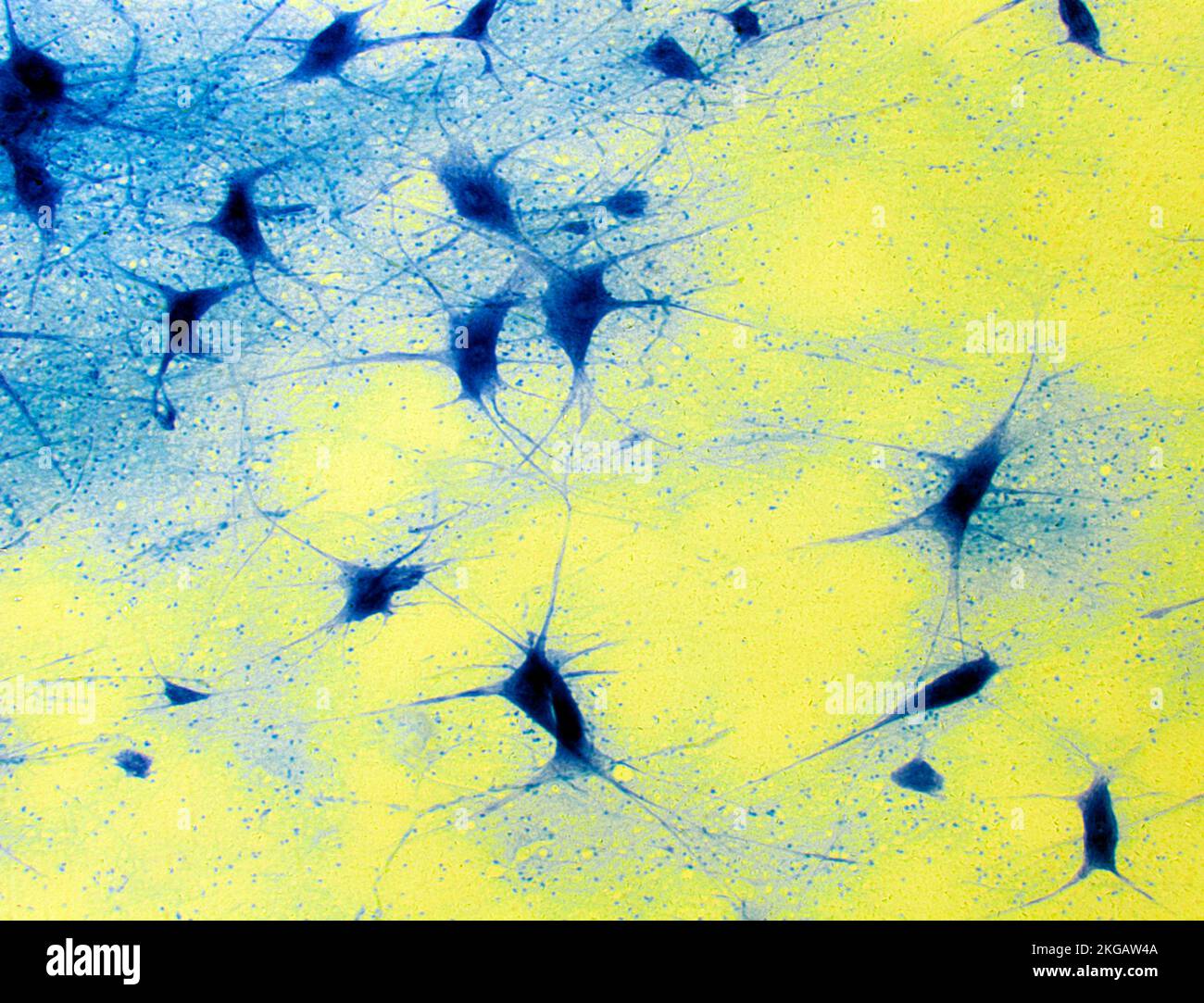 Nerve cell, light micrograph. Nerve cells, or neurons, are responsible ...