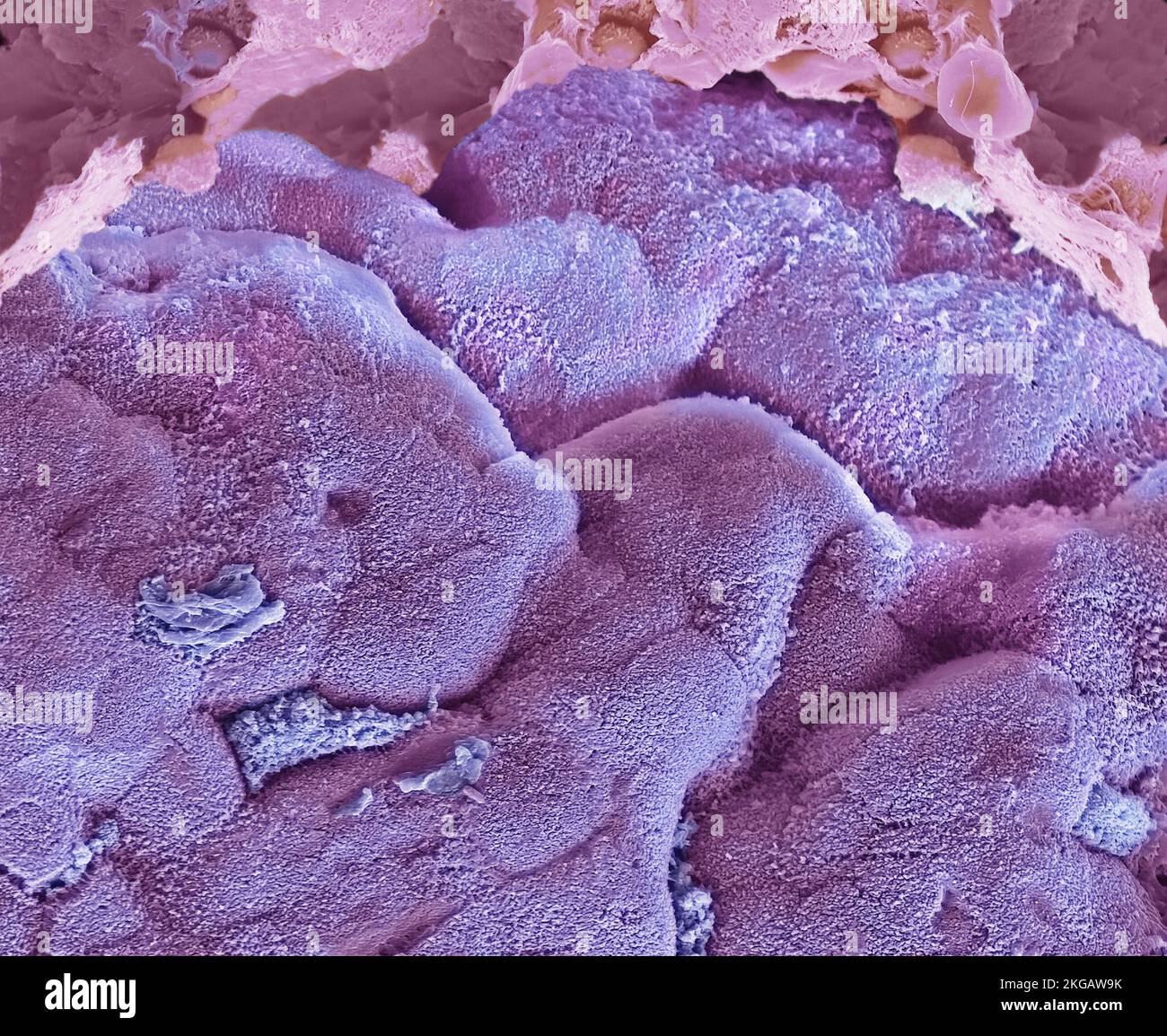 Appendix. Coloured scanning electron micrograph (SEM) of the wall of ...