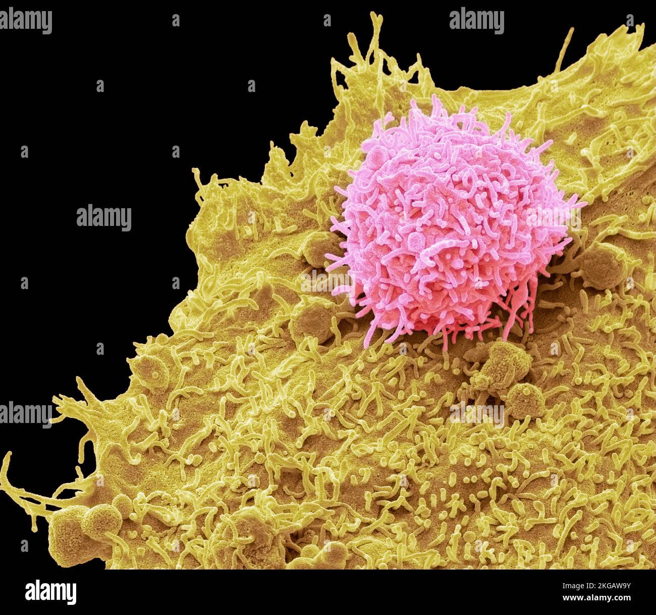 Car T Cell Therapy Coloured Scanning Electron Micrograph Sem Of A T Cell Pink And A