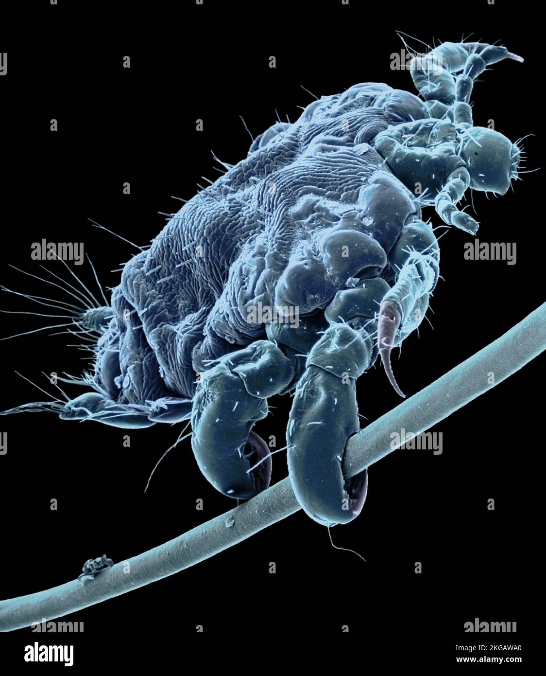 Pubic louse. Scanning electron micrograph (SEM) of the pubic louse ...