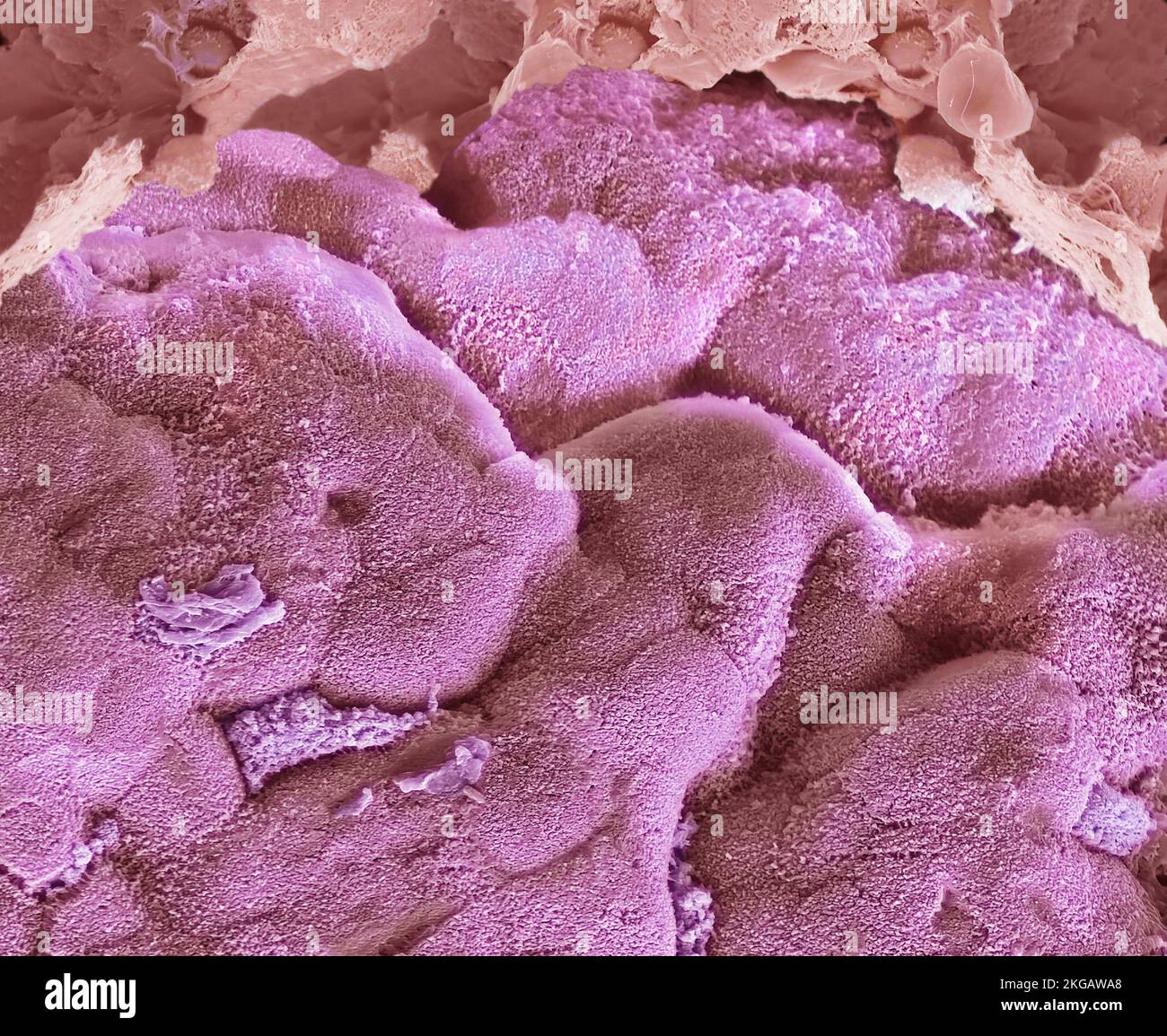 Appendix. Coloured scanning electron micrograph (SEM) of the wall of ...