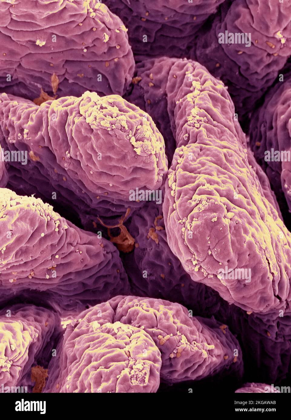 Small intestine. Coloured scanning electron micrograph (SEM) looking ...