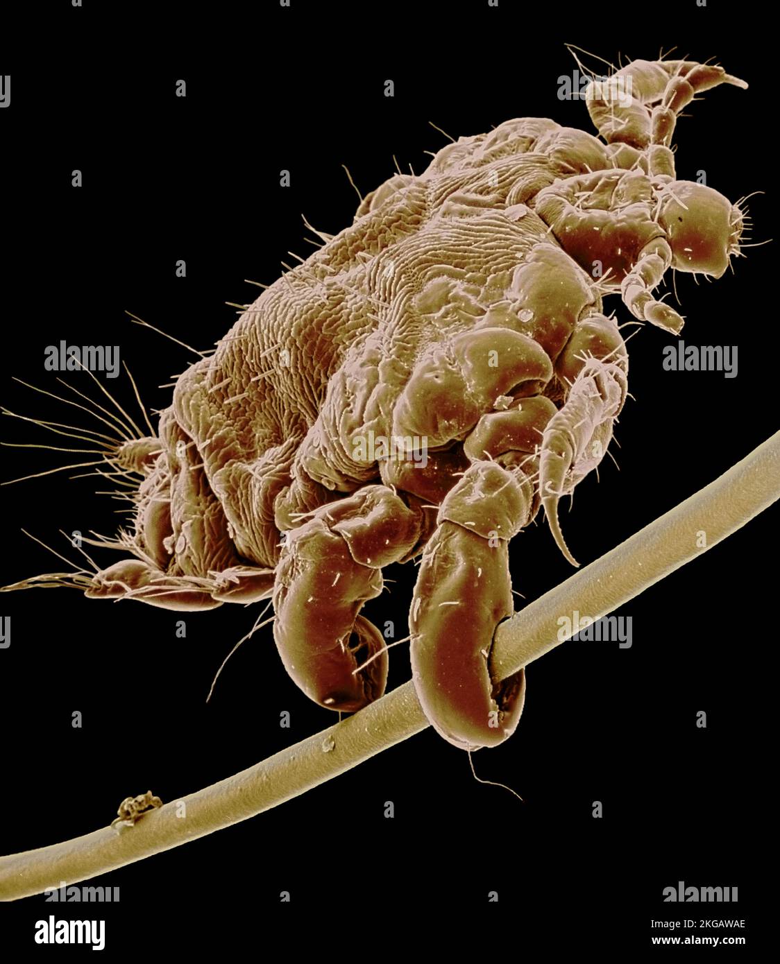 Pubic louse. Scanning electron micrograph (SEM) of the pubic louse, Phthirus pubis, also known ...