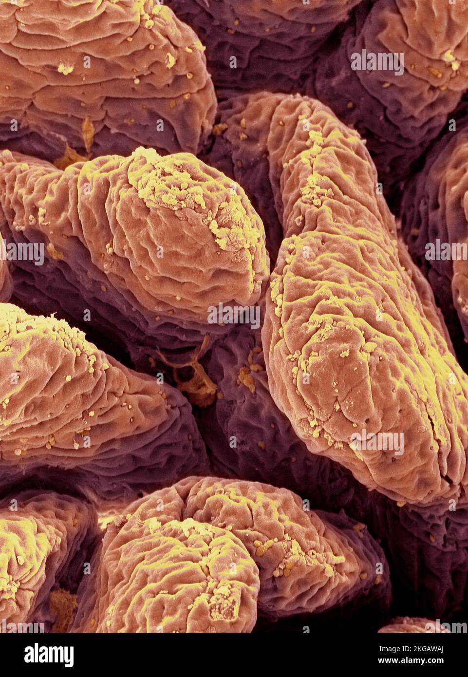 Small Intestine Coloured Scanning Electron Micrograph Sem Looking Down On A Surface Of The