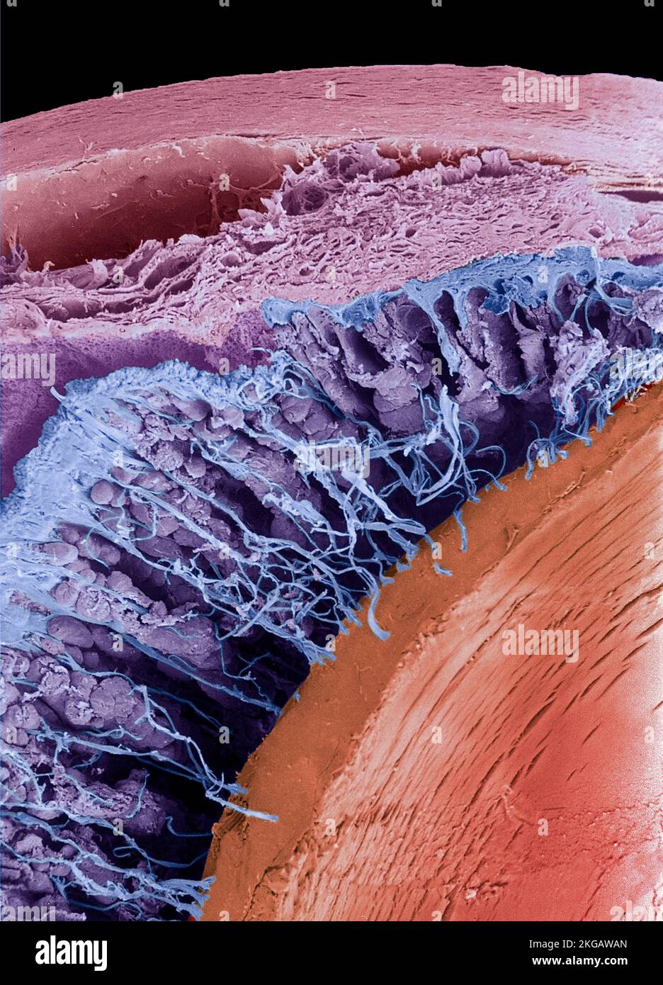 Iris of the eye. Coloured scanning electron micrograph (SEM) of the ...