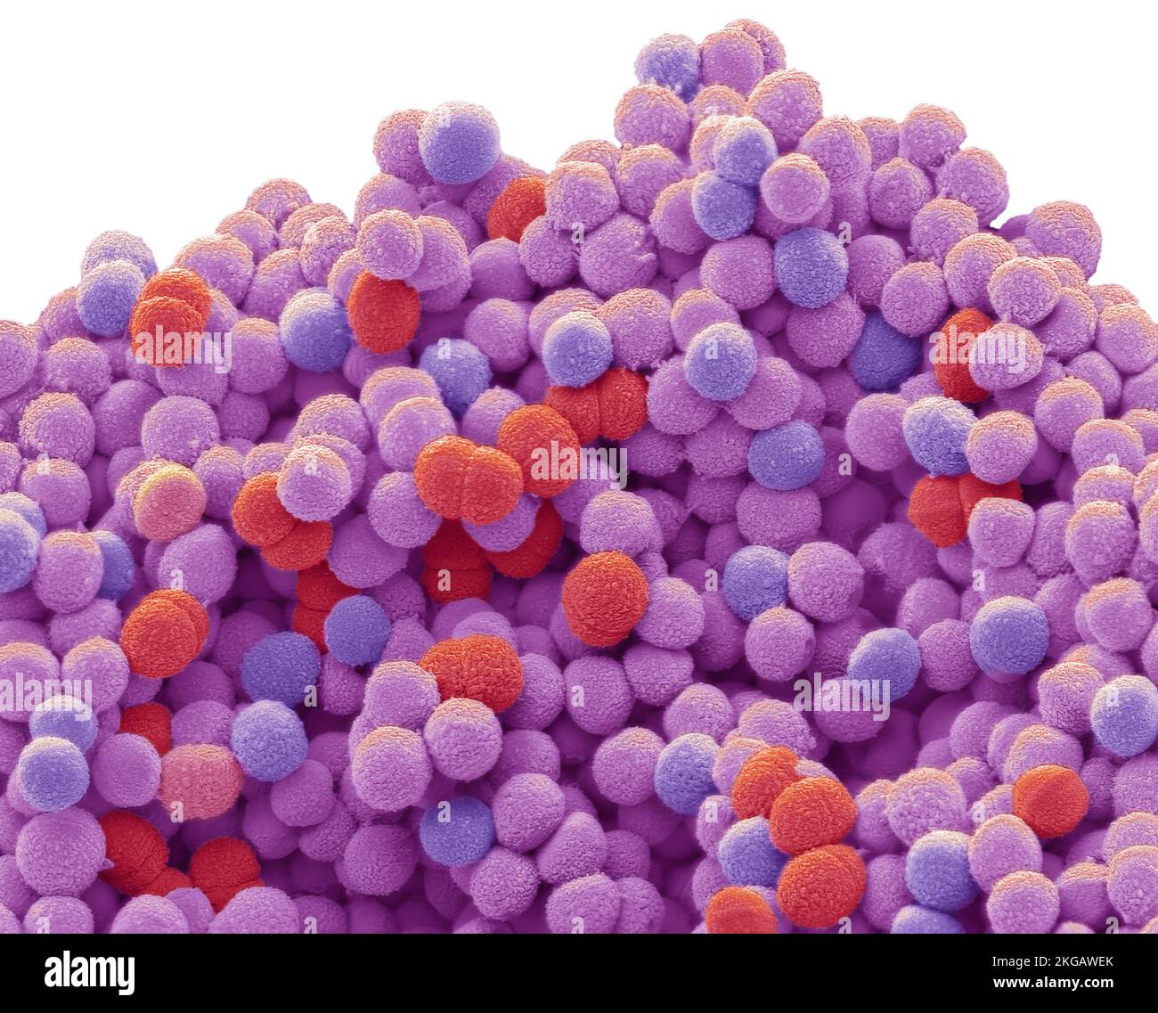 Bacteria culture from urine. Coloured scanning electron micrograph (SEM ...