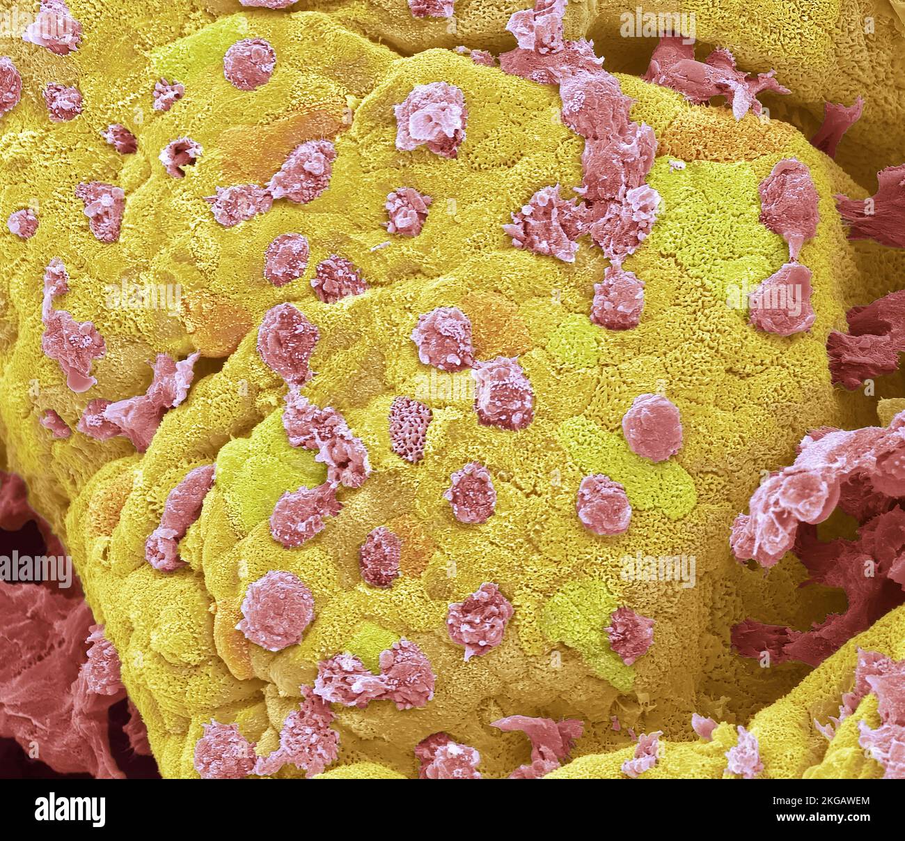 Colon. Colour scanning electron micrograph (SEM) of the wall of the ...