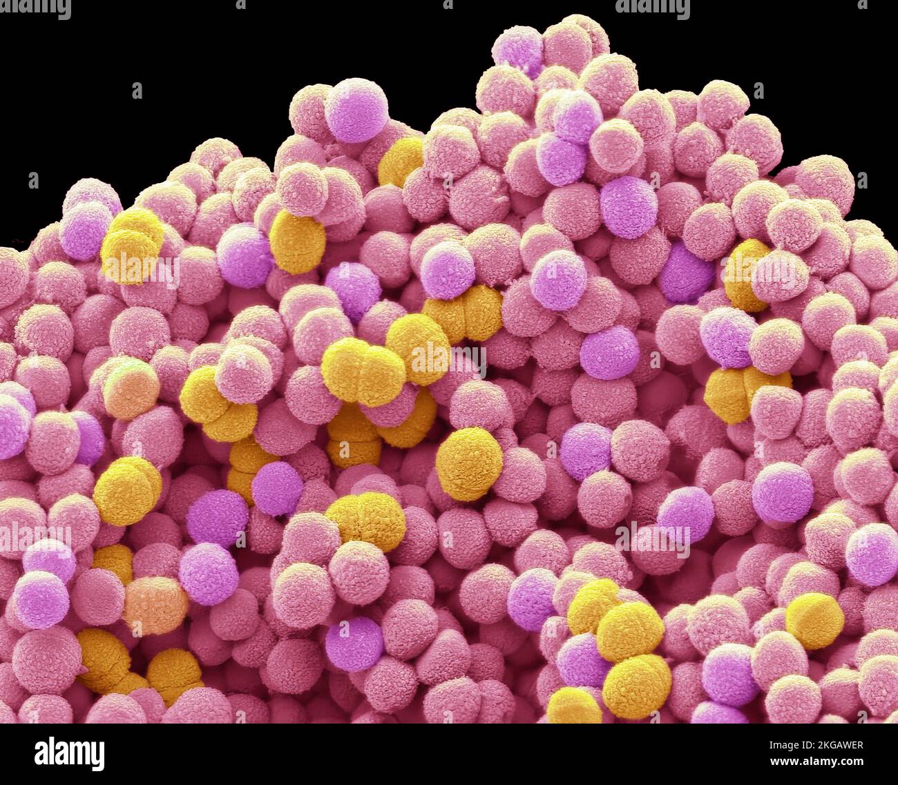 Bacteria culture from urine. Coloured scanning electron micrograph (SEM ...