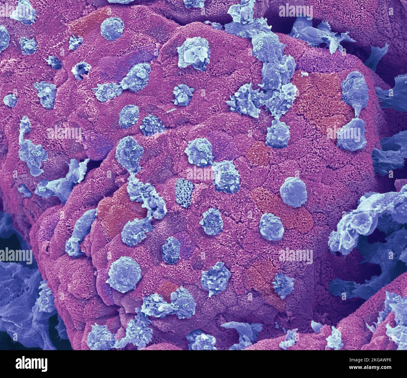 Colon. Colour scanning electron micrograph (SEM) of the wall of the ...