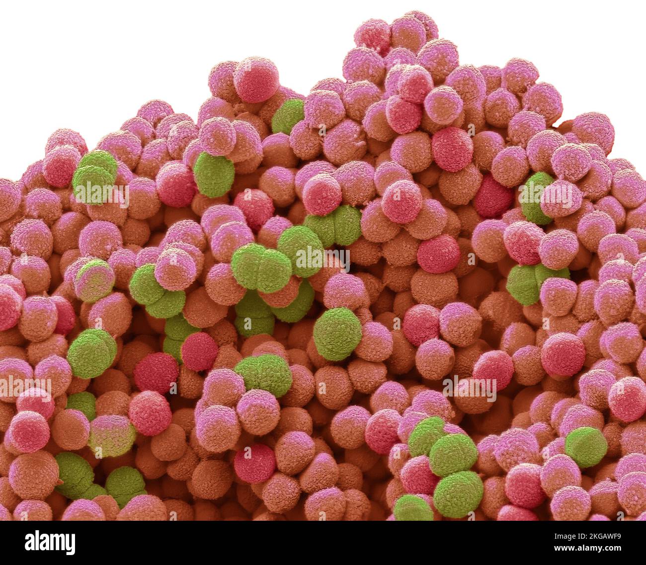 Bacteria culture from urine. Coloured scanning electron micrograph (SEM ...