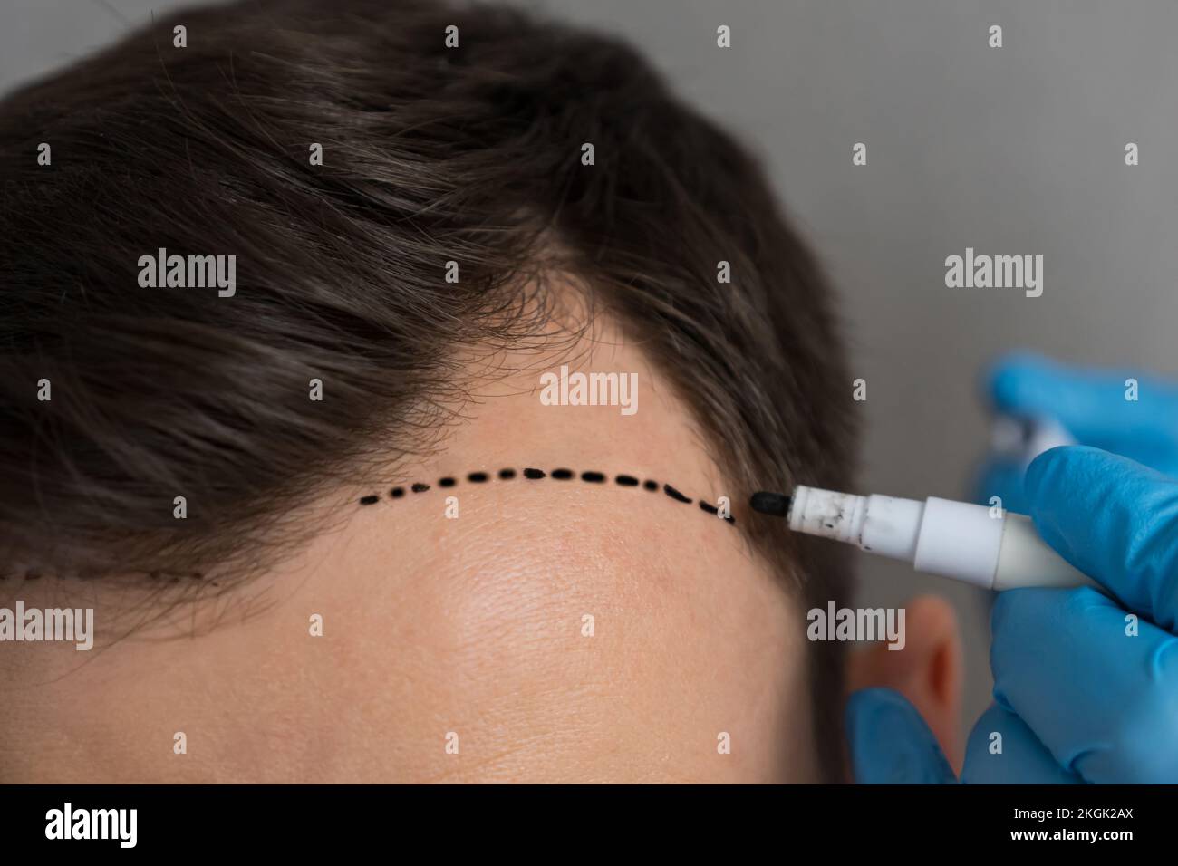 Bald man touch head hi-res stock photography and images - Alamy