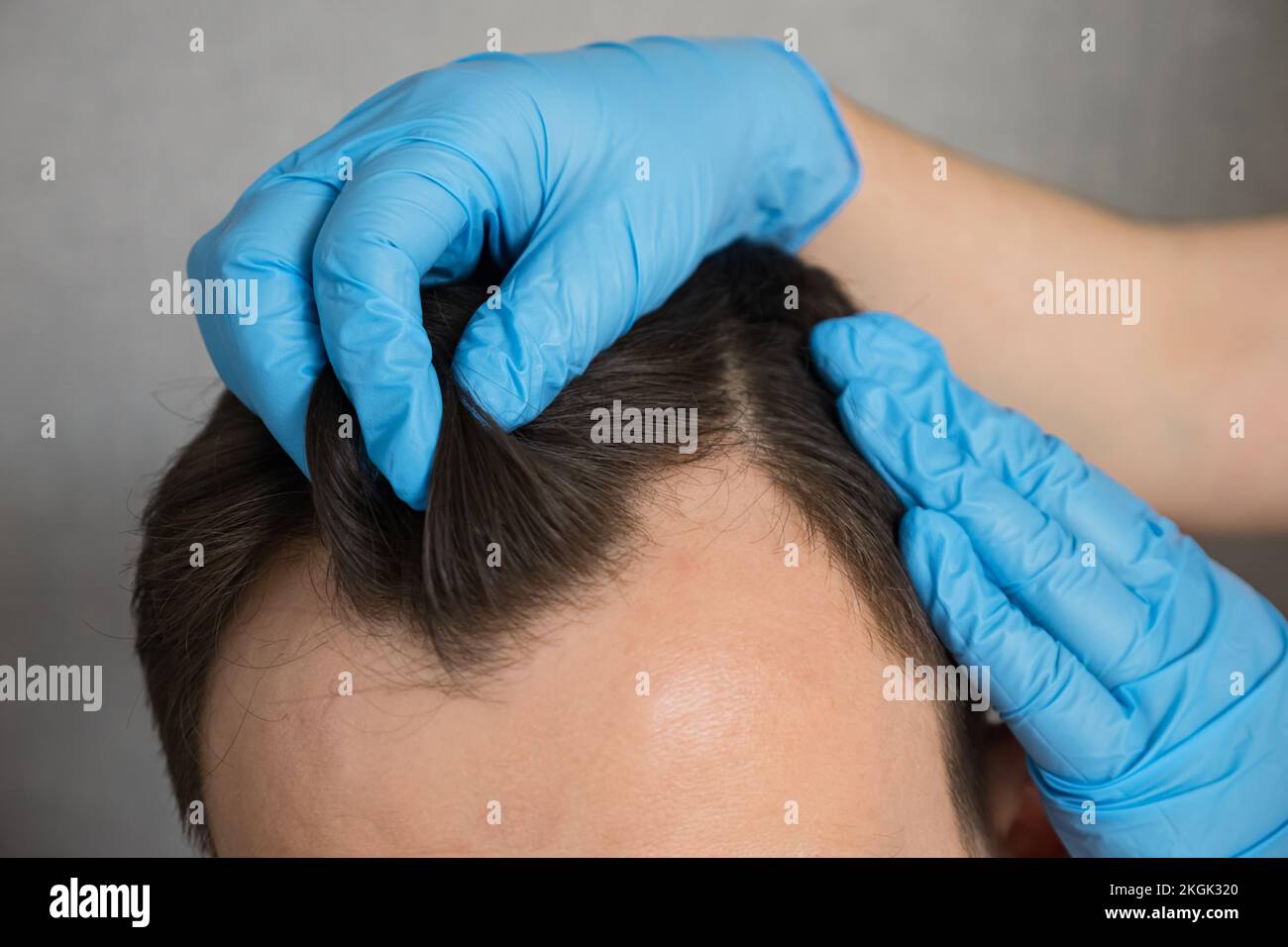 Hands of doctor in rubber gloves doing checkup of hair Stock Photo - Alamy