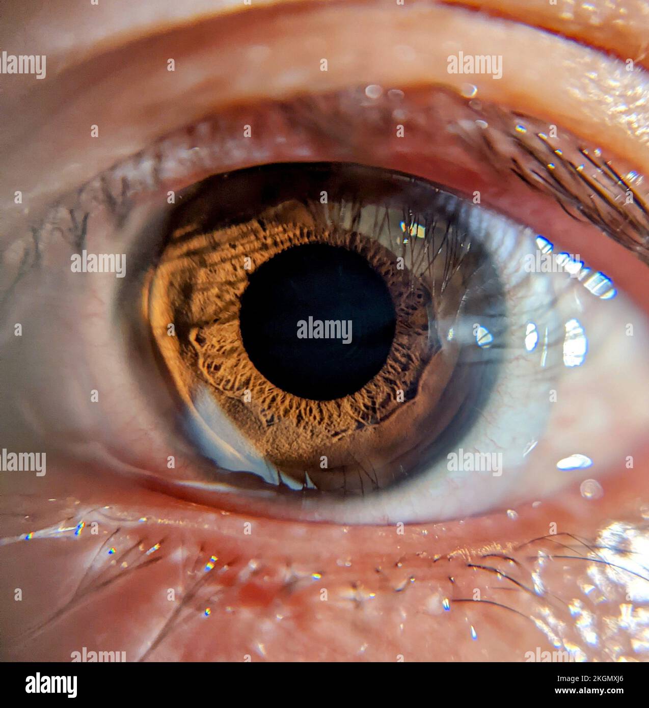 A macro shot of a wide opened human eye Stock Photo - Alamy