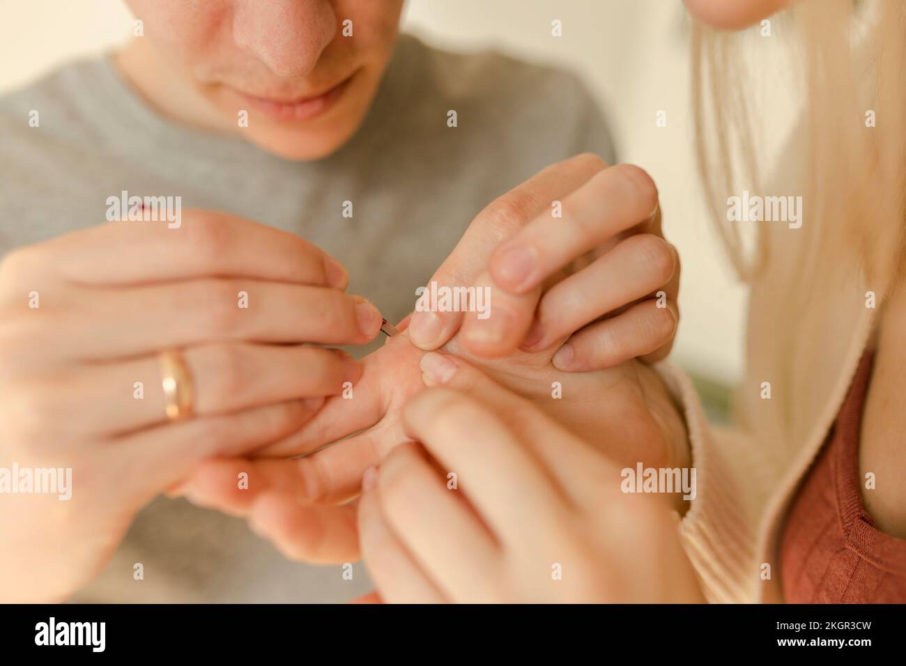 Hand splint hi-res stock photography and images - Alamy