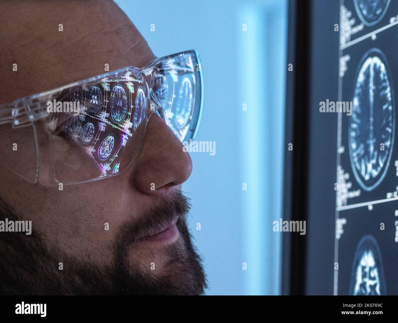 Doctor wearing eyeglasses looking at MRI scan Stock Photo - Alamy