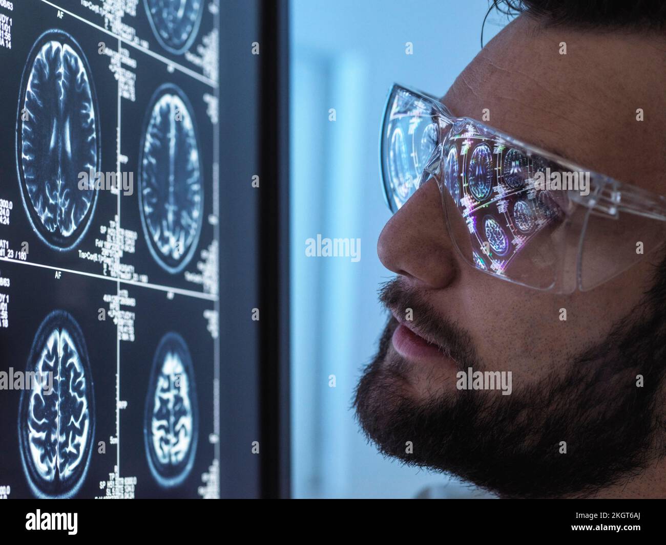 Dementia brain mri scan hi-res stock photography and images - Alamy