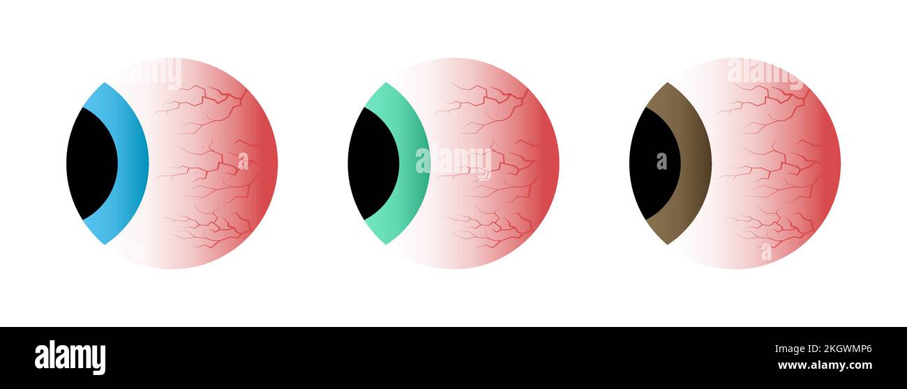 Eyelid with blood vessels veins hi-res stock photography and images - Alamy