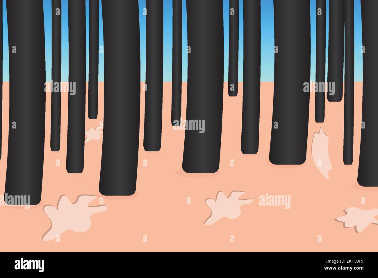 Dandruff on head skin with long hair vector. Hair scalp treatment and ...