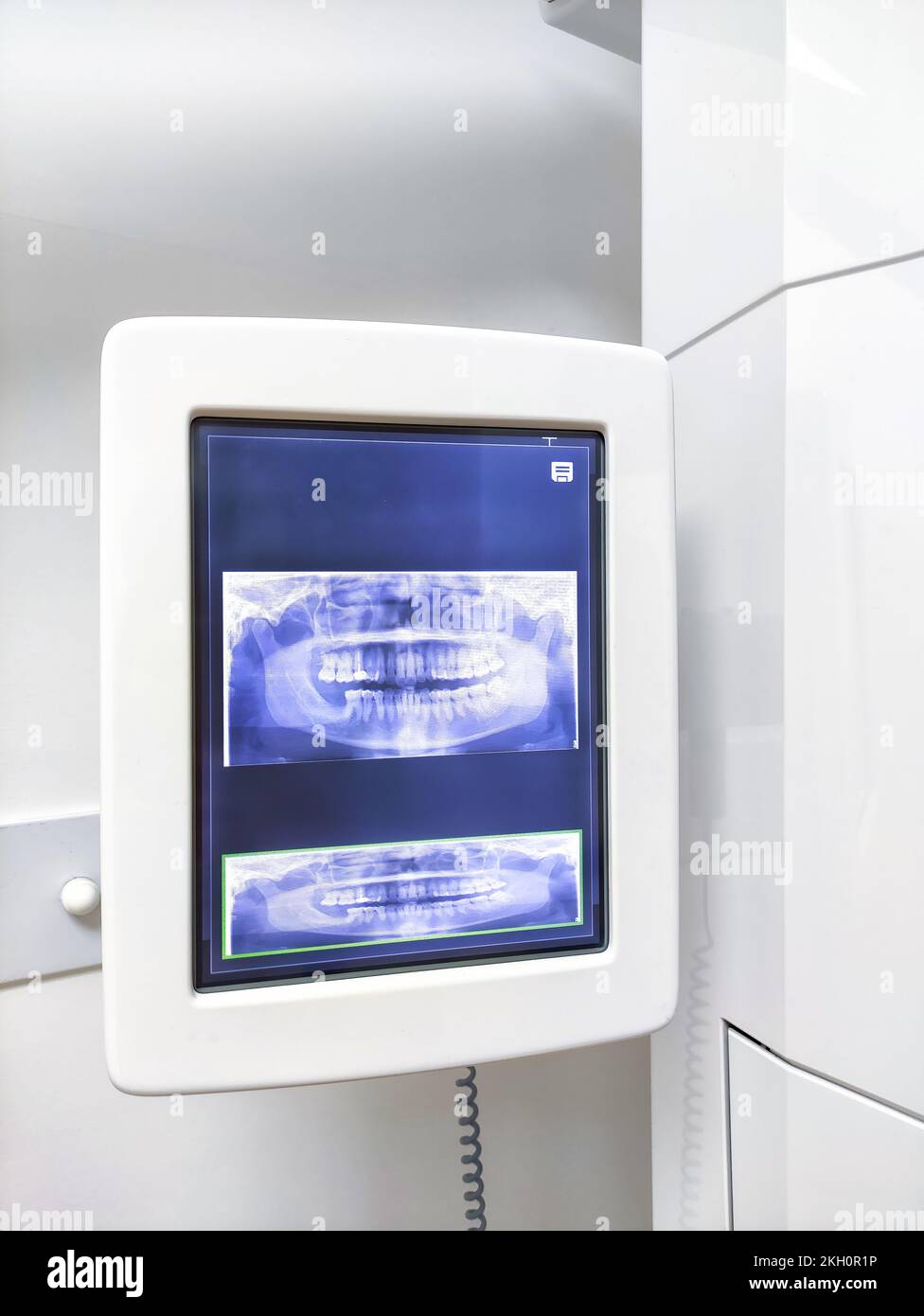 Radiologist x ray machine and screen hi-res stock photography and ...