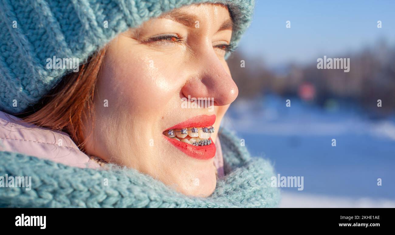 The girl has braces on her teeth. A girl in the winter on the street ...