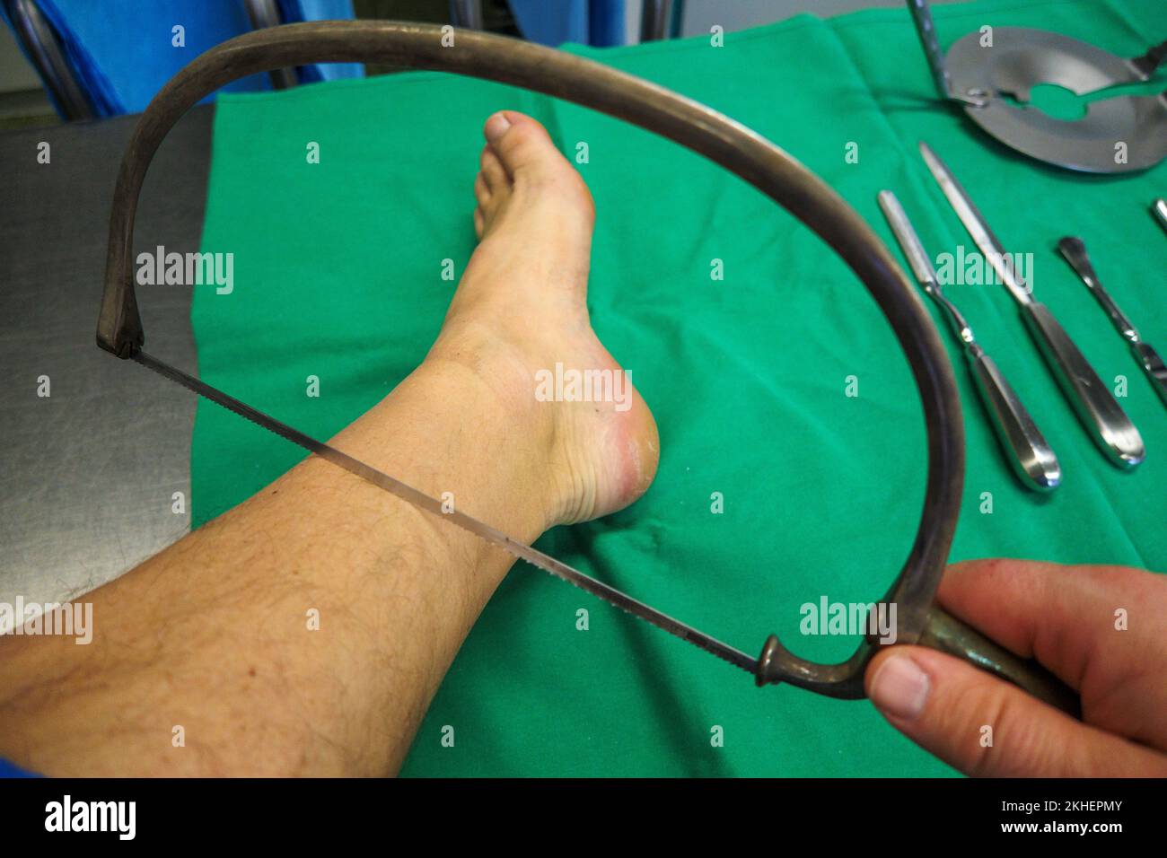 an amputation saw is applied to one leg in an operating room Stock ...