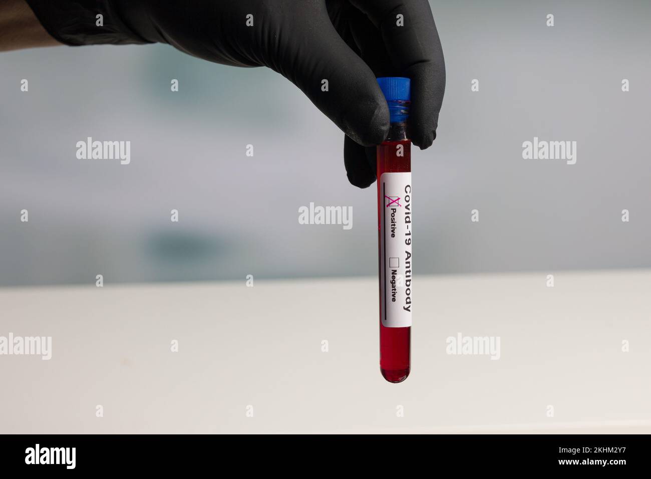 hand in black medical gloves is handling a blood probe for covid ...