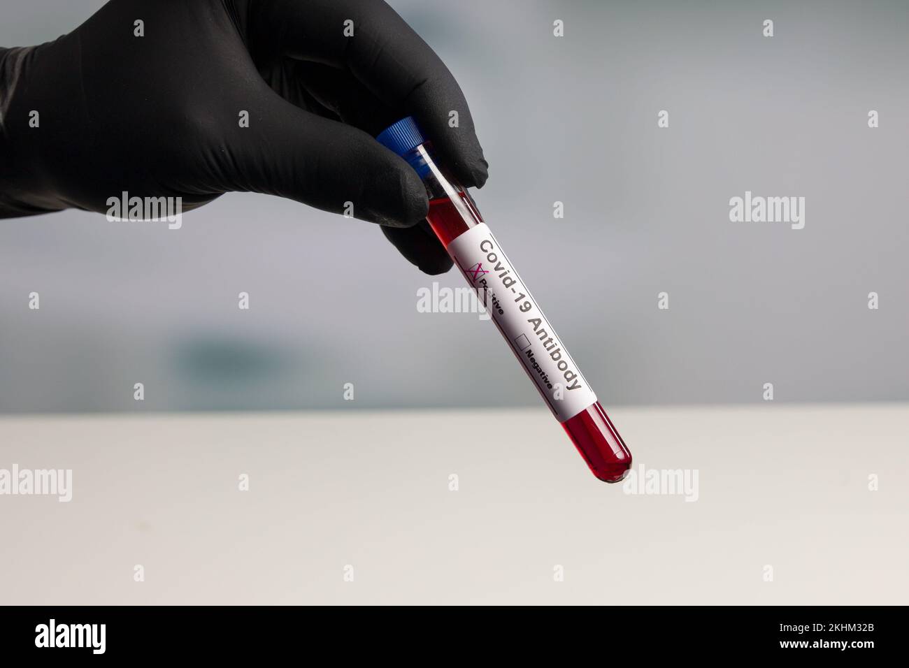 hand in black medical gloves is handling a blood probe for covid ...