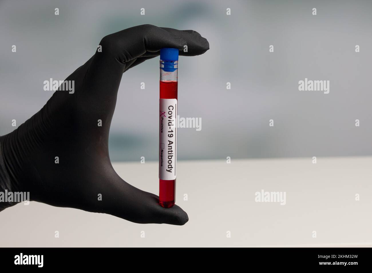 hand in black medical gloves is handling a blood probe for covid ...