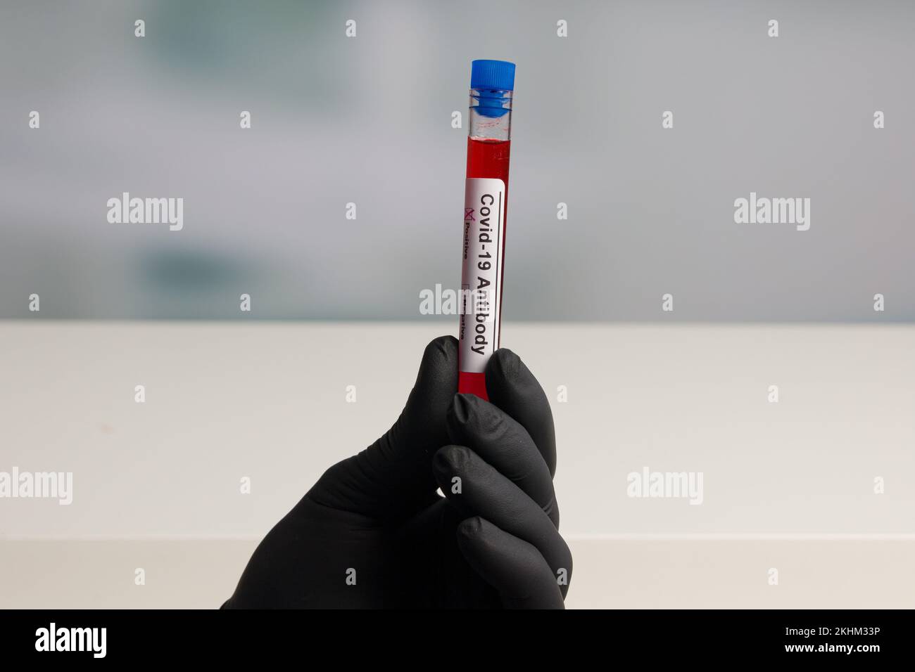 hand in black medical gloves is handling a blood probe for covid ...