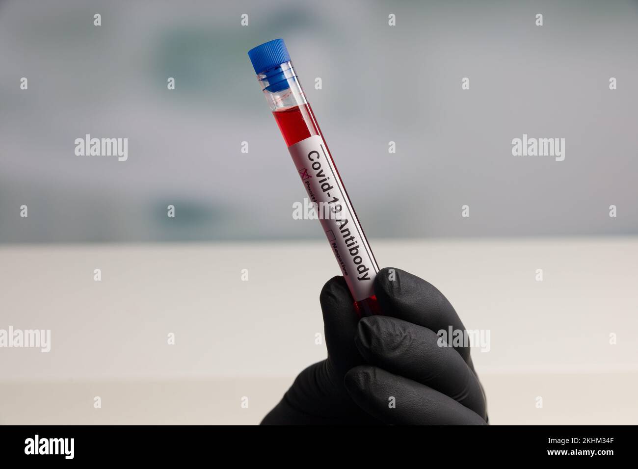 hand in black medical gloves is handling a blood probe for covid ...