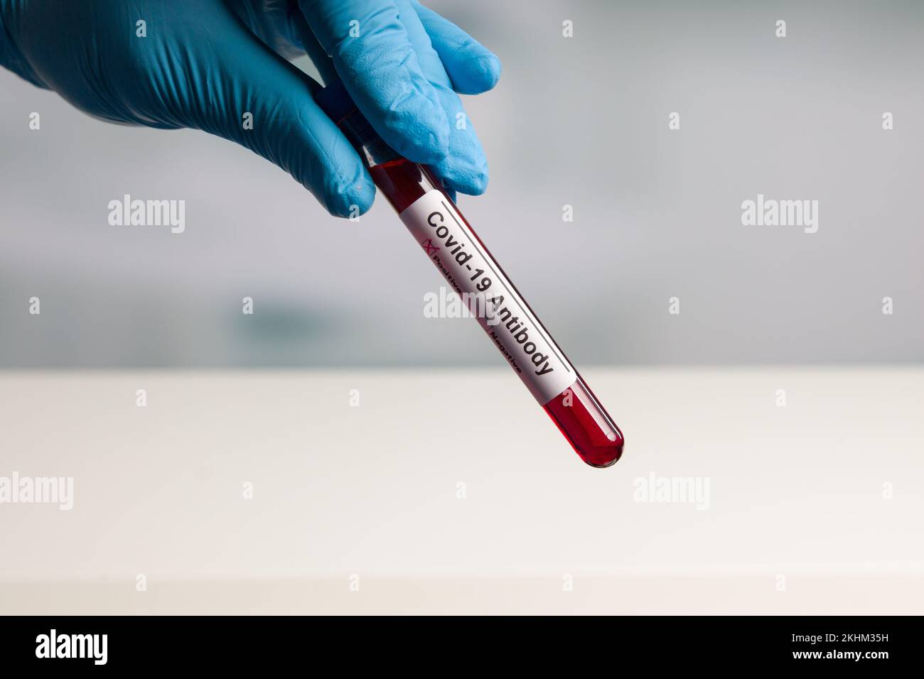 hand in medical gloves is handling a blood probe for covid analysis in ...