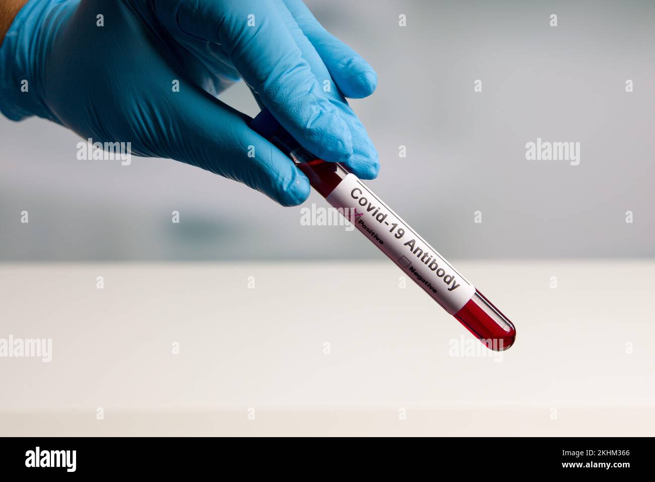 hand in medical gloves is handling a blood probe for covid analysis in ...