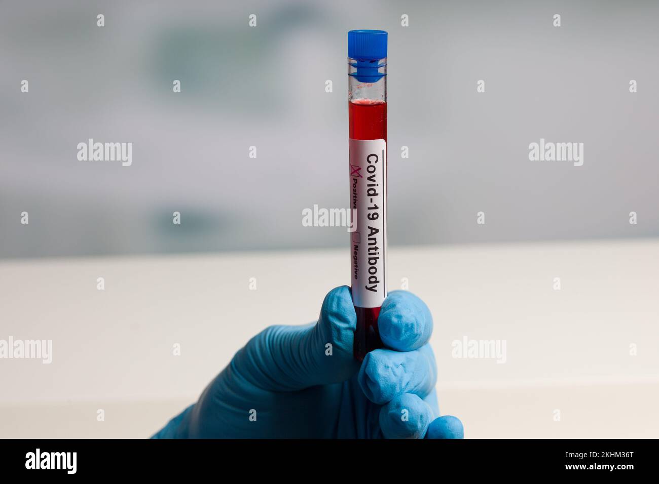hand in medical gloves is handling a blood probe for covid analysis in ...