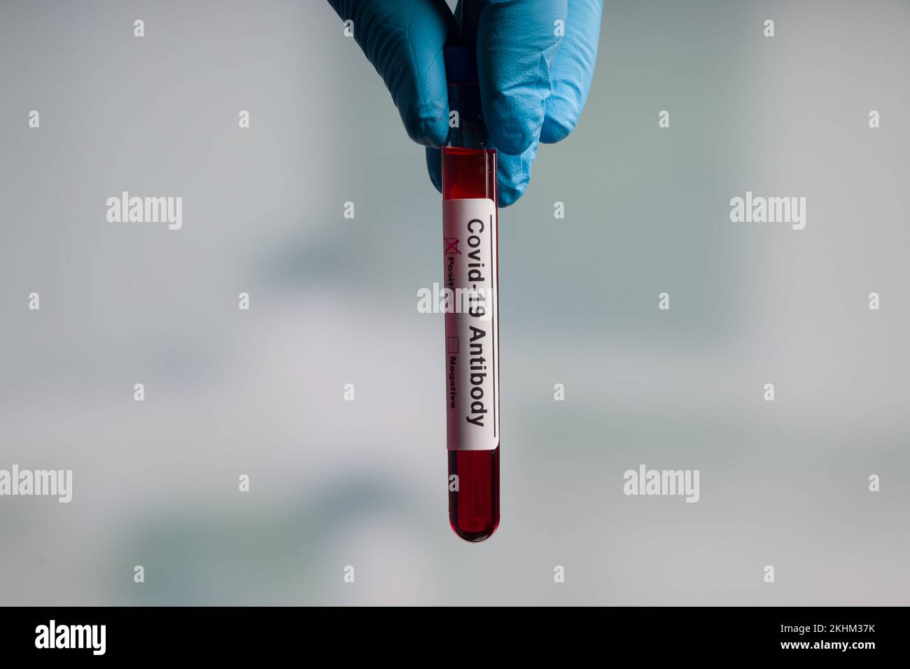 hand in medical gloves is handling a blood probe for covid analysis in ...