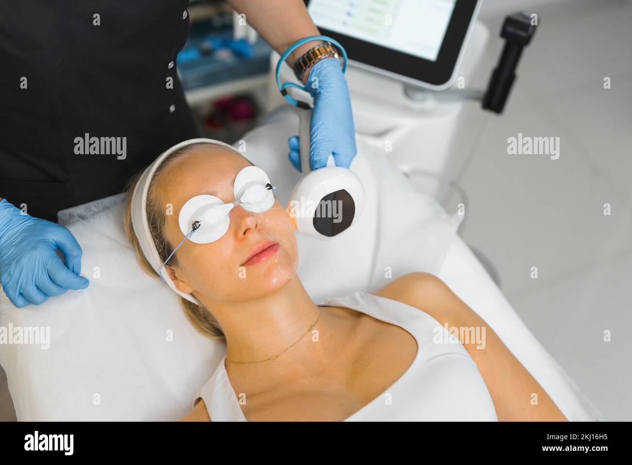 medium closeup view of a Caucasian woman undergoing non surgical face ...